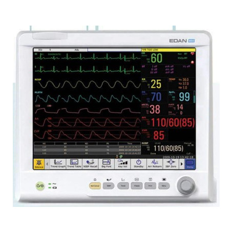 Edan iM80 patient monitor