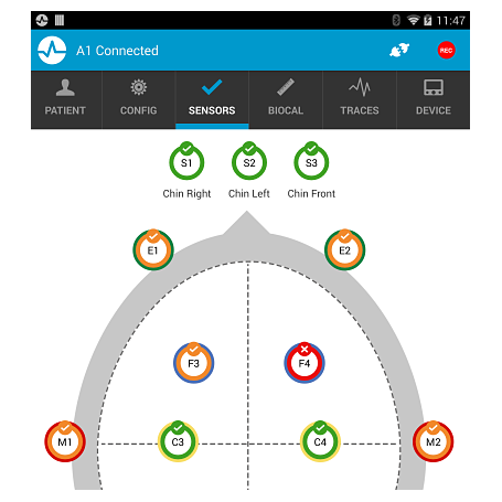 Nox A1 sleep diagnostic system