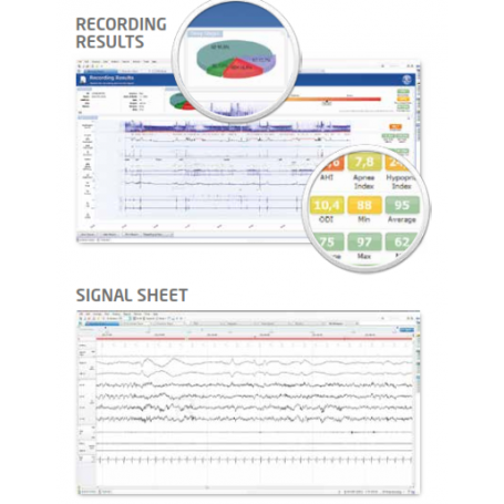 Nox A1 sleep diagnostic system