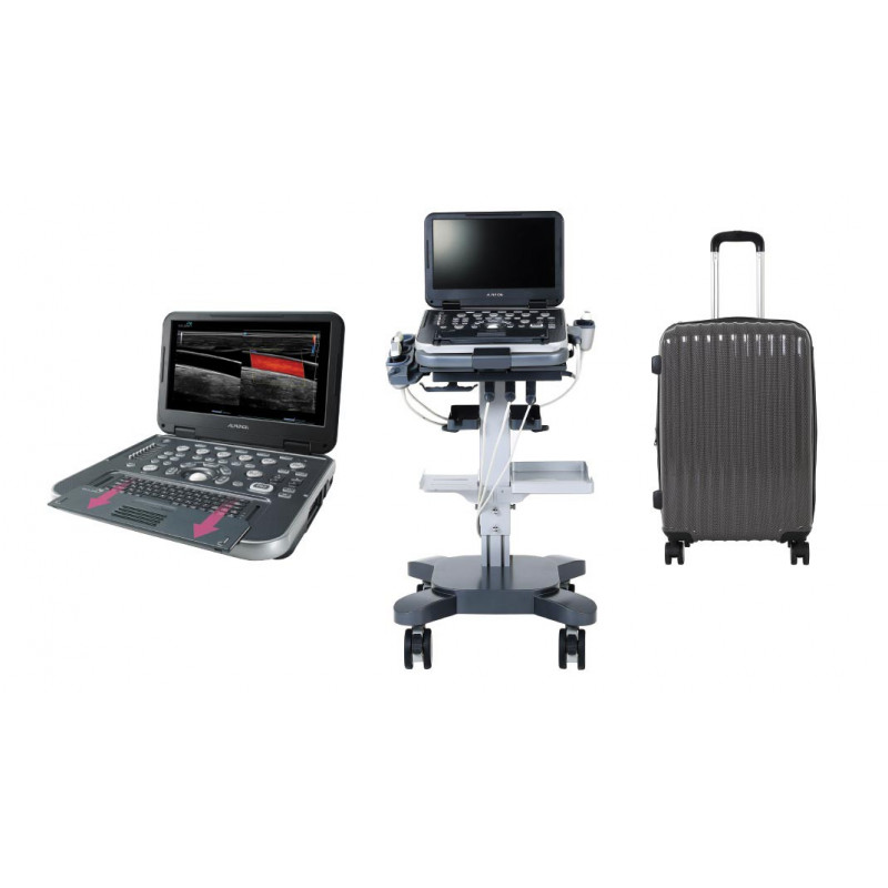 Alpinion E-Cube i7 portable ultrasound