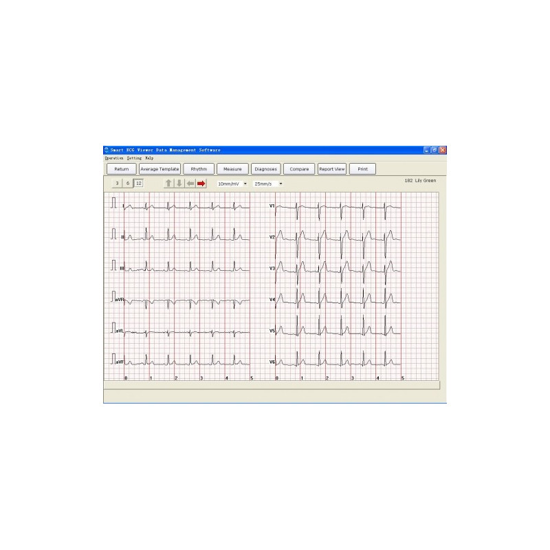 Smart ECG Viewer PC Software